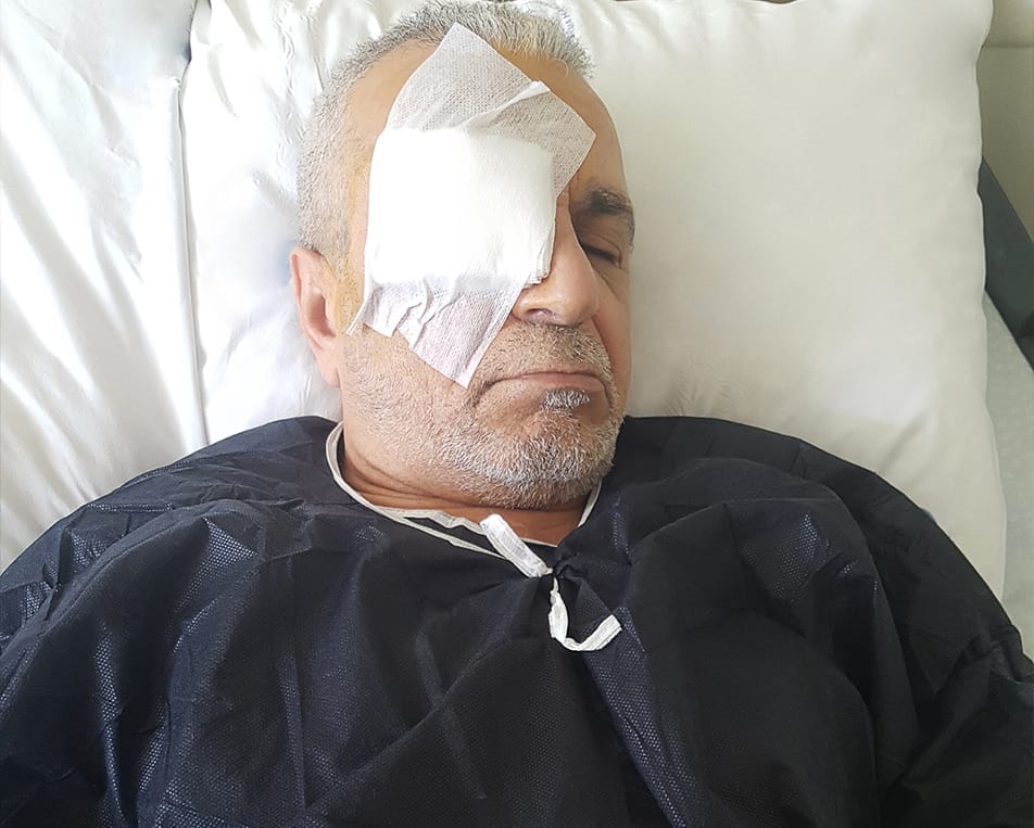 Eye Surgery Malpractice Attorney Miami | Alvarez Law Firm