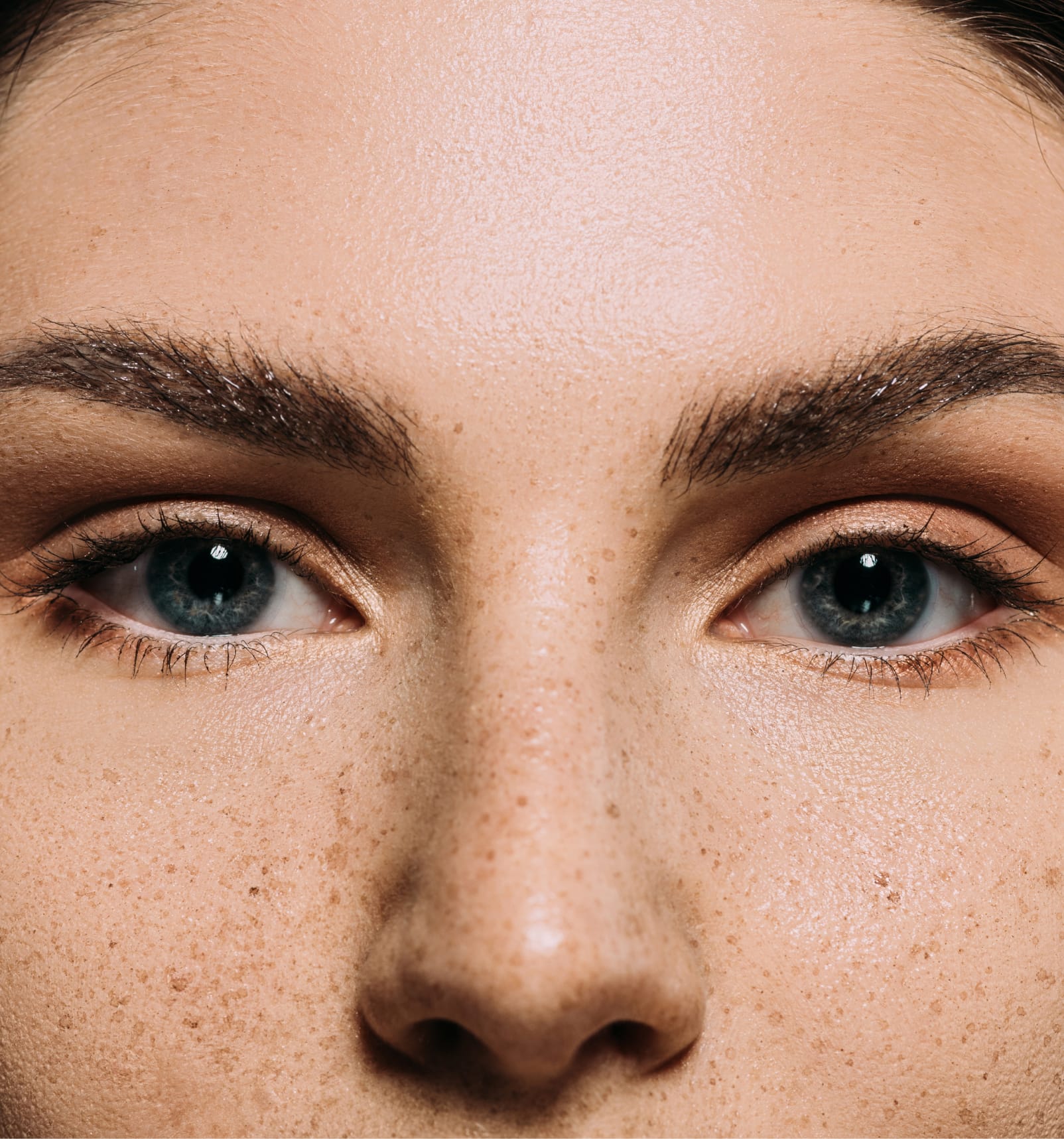 Blepharoplasty in The Woodlands | Eyelid Surgery in Spring, TX