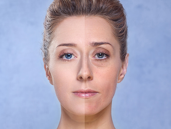 What Does It Mean To Have An Asymmetric Face? | Spiegel, Jeffrey ...
