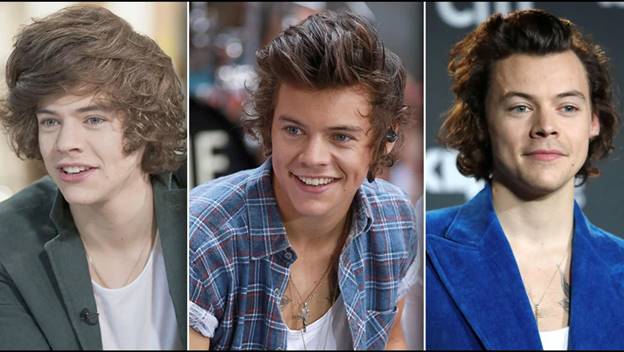 Did Harry Styles get a Nose Job? | Spiegel, Jeffrey (drspiegel.com)