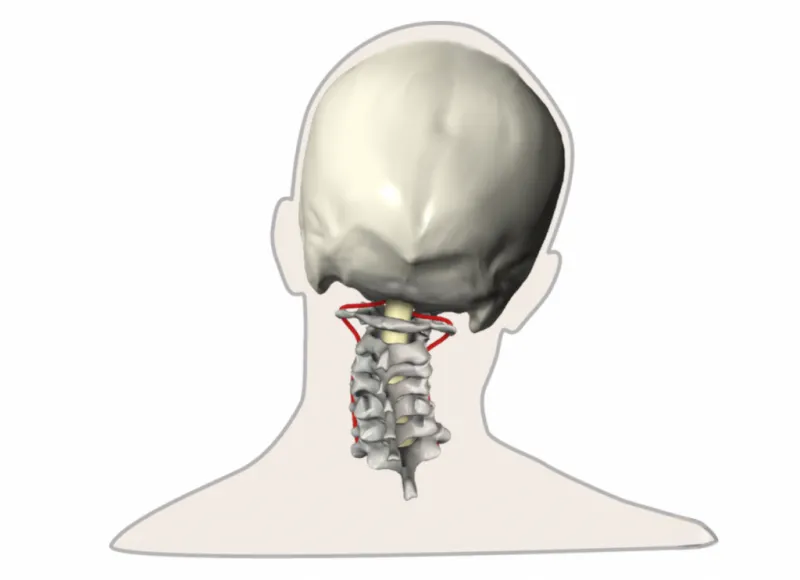 What is a Subluxation? - Chiropractor San Diego CA