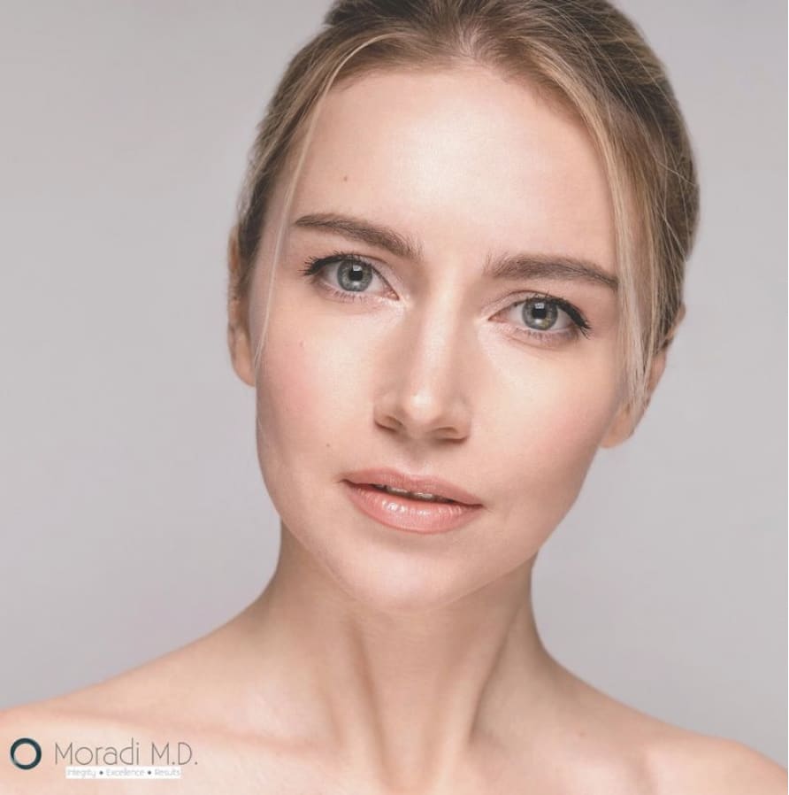 San Diego, CA Facial Plastic Surgery | Moradi M.D.