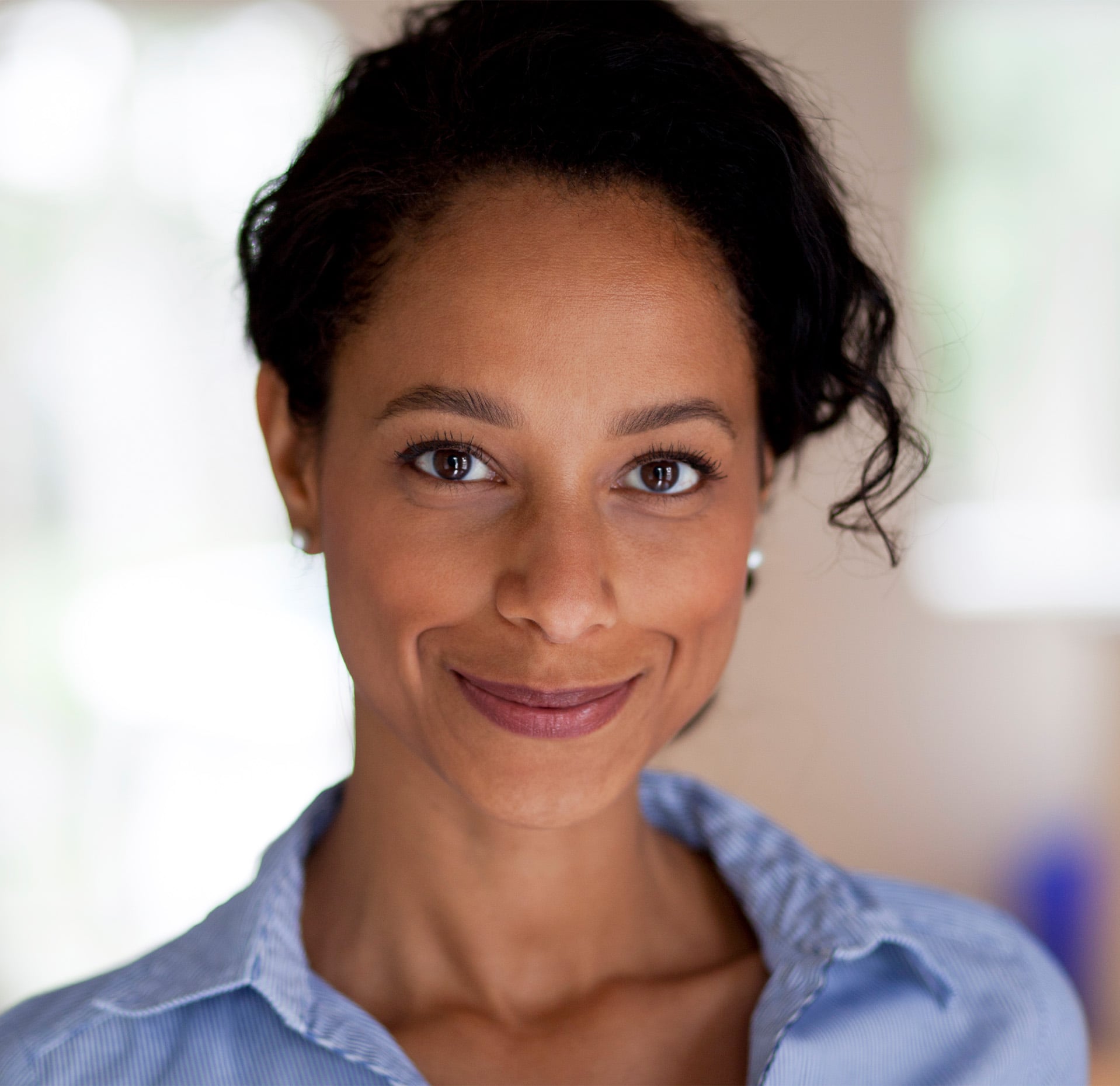 Sculptra San Diego | Moradi MD