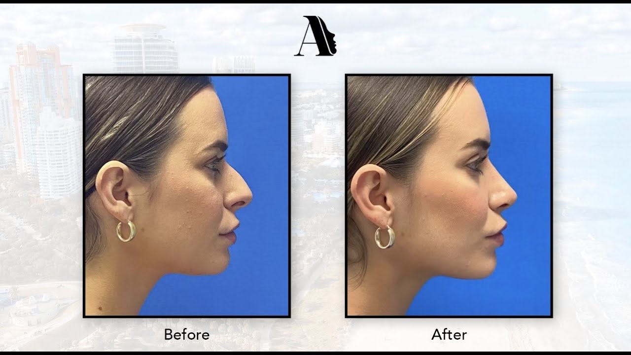 Videos | Dr. Paul Afrooz