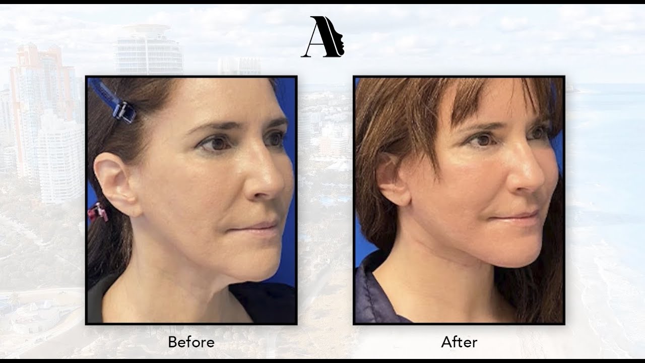 Videos | Dr. Paul Afrooz