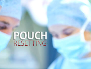 The Bariatric Pouch Reset - Managing Weight Regain