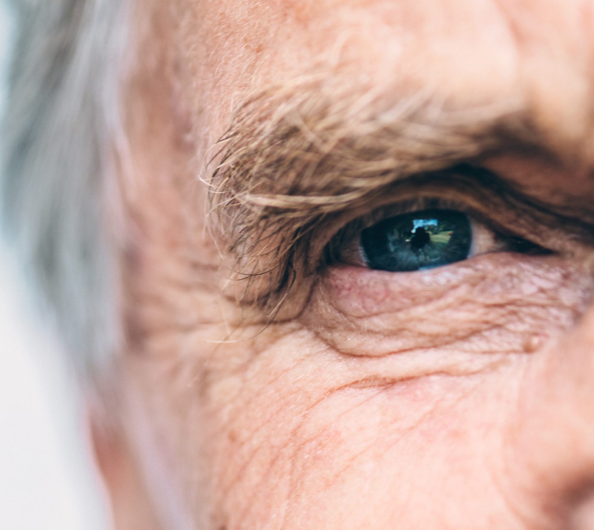 Vivity Intraocular Lens - Chicago Cornea Consultants™